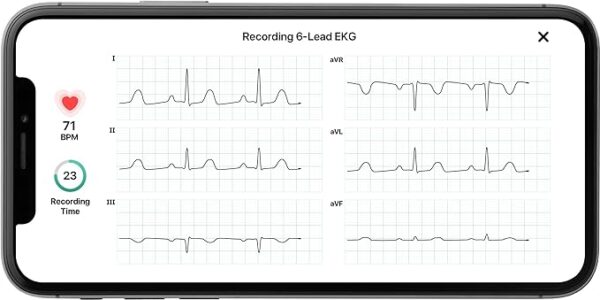 ECG Monitor - AT HOME MONITORING